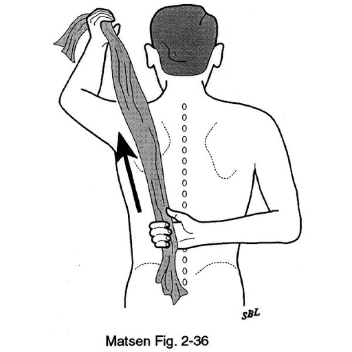 Rehabilitation After Shoulder Arthroplasty Uw Orthopaedics And Sports Medicine Seattle