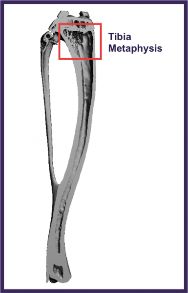 Assessing focal alterations in bone morphology via temporal microCT ...